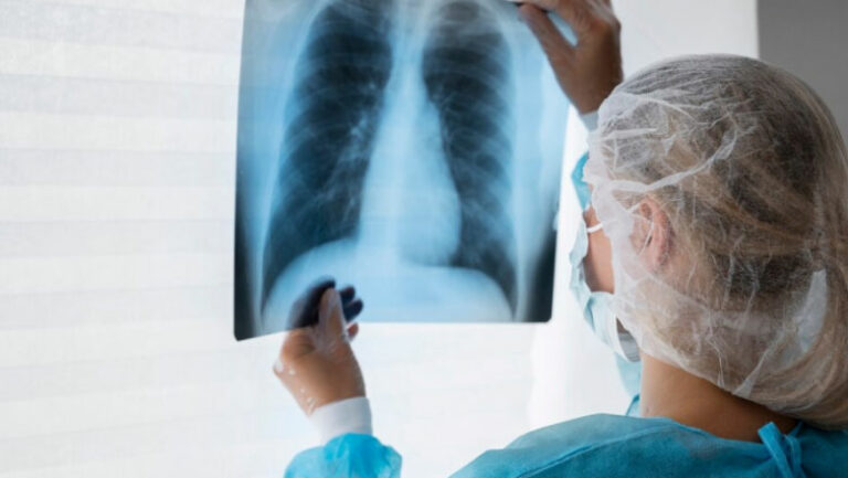 Pneumotoraxul – simptomatologie, evaluare si metode de tratament | Medacces